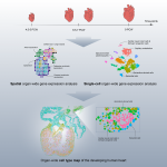 A study on human heart development – HDCA Sweden